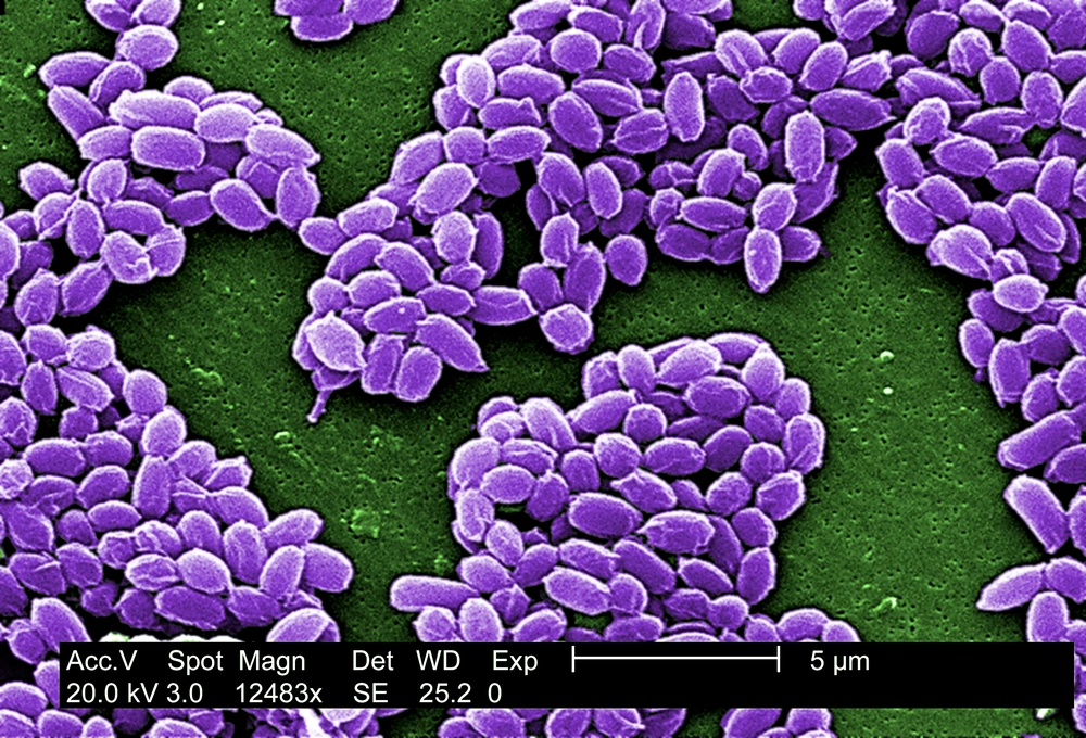 DVIDS - Images - Anthrax Spores Revealed Under Electron Microscope
